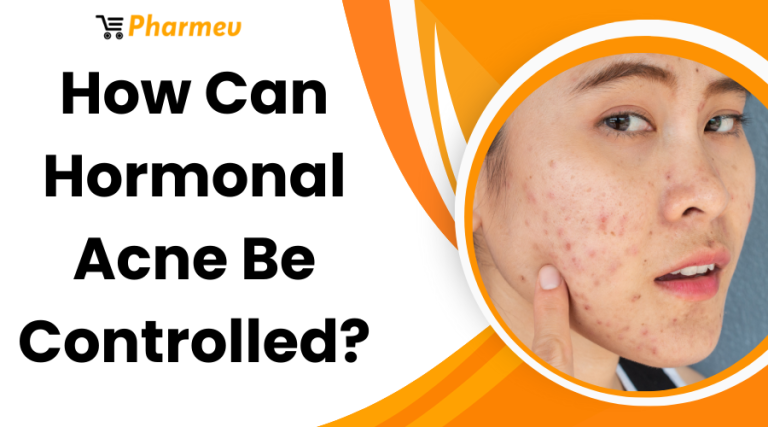 How Can Hormonal Acne Be Controlled? - Pharmev